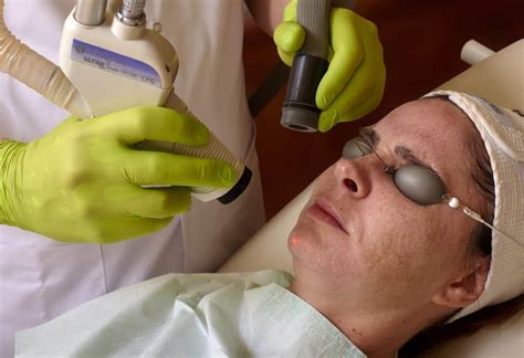 Laser Frakcyjny Ablacyjny Dermatologia Medycyna Estetyczna Zielona