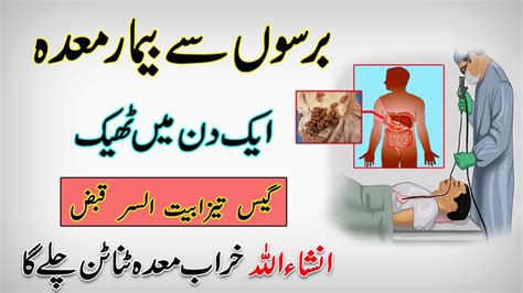 Pait Ki Gas Jalan Aur Tezabiat Ka Ilaj Stomach Ulcer Treatment