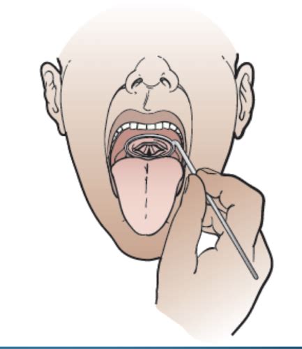 ENT Exam 1 Larynx Upper Trachea 7 Flashcards Quizlet