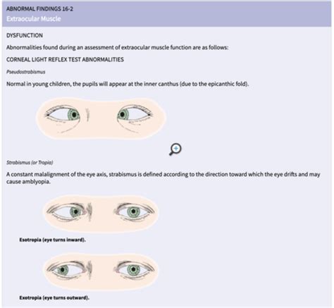 Chapter Assessing Eyes Flashcards Quizlet