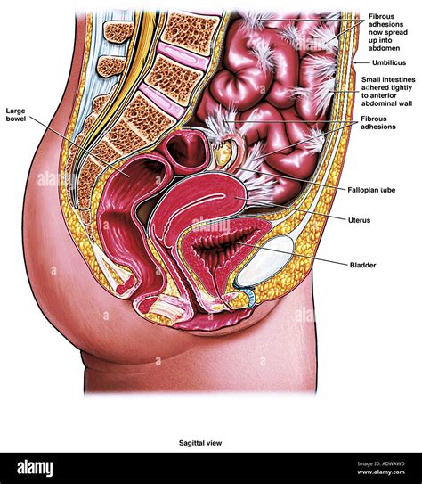 DIAGRAM Diagram Of Female Intestines MYDIAGRAM ONLINE
