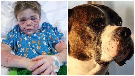 Niño de 7 años queda desfigurado tras ser atacado por un perro en Texas