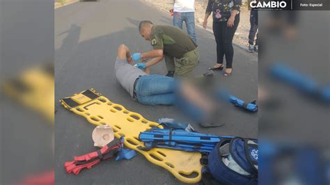 Motociclista Termina Fracturado De Una Pierna Tras Ser Atropellado En
