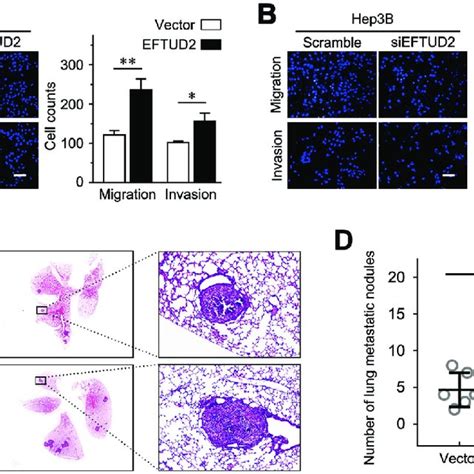 EFTUD2 Promotes The Migration And Invasion Of HCC Cells A B Transwell