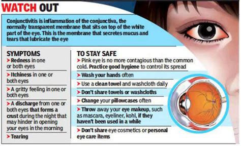 146 Images Viral Conjunctivitis For FREE MyWeb