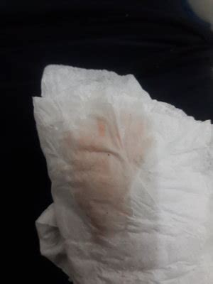 Topo 63 Imagem Sangramento Rosa Pode Ser Gravidez Br Thptnganamst Edu Vn