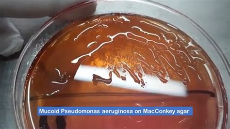 Atlas Of Bacteria Introduction And List Of Bacteria And Related Features