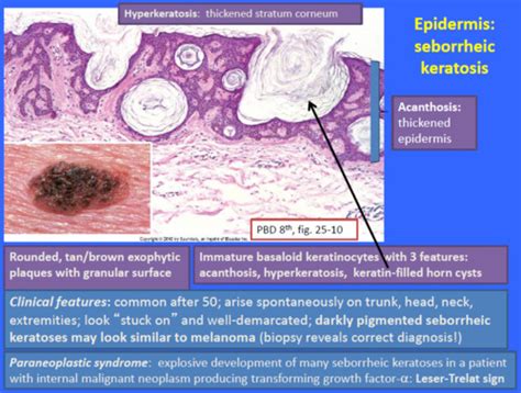 Pathology Exam 4 Flashcards Quizlet
