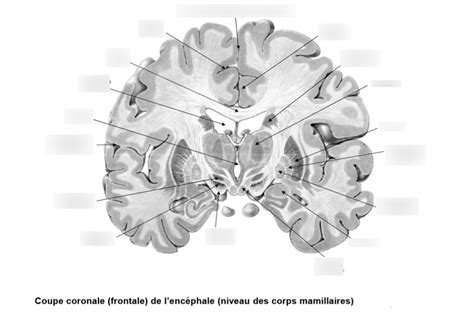 Neuroanatomie Humaine Interbrain Coupe Coronale Frontale De L