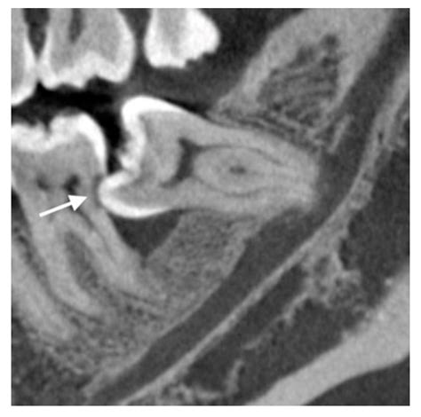 Diagnostics Free Full Text Application Of Cone Beam Computed