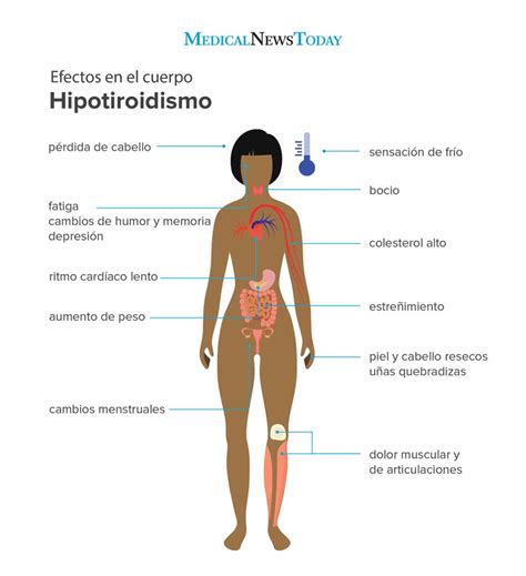 Síntomas de hipotiroidismo 12 signos a tener en cuenta