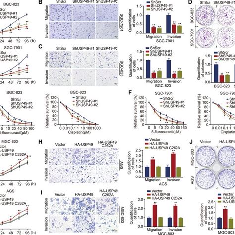 USP49 Promotes Proliferation Metastasis And Drug Resistance In GC