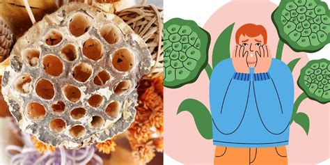 Tripofobia en niños cuáles son sus causas y qué síntomas presentan