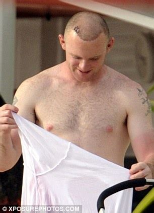 Wayne Rooney Hair Transplant Hair Loss Cure Could Help Boost Your