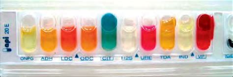 The Api Ne Biom Rieux Is A Commercial Biochemical Identification