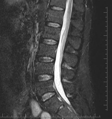 Case Of The Week Radiology Case Cafe