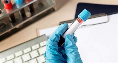 Quais exames de sangue mostram o tipo sanguíneo Clude