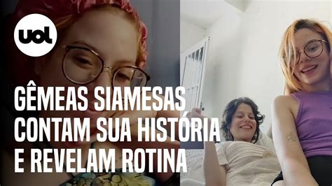 Gêmeas siamesas compartilham rotina nas redes sociais YouTube