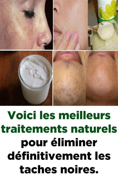Voici Les Meilleurs Traitements Naturels Pour Liminer D Finitivement