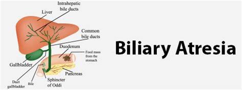 Biliary Atresia Medizzy