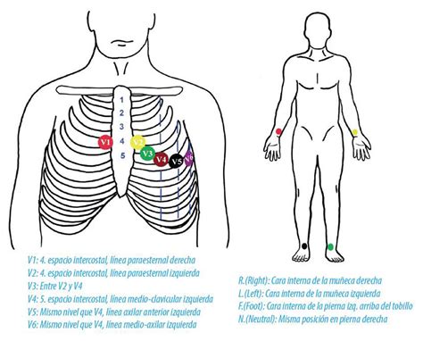 Enfermeras a cuadros Electrocardiograma la actividad del corazón