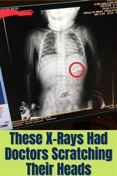 These X Rays Had Doctors Scratching Their Heads X Ray Humor Funny Fails
