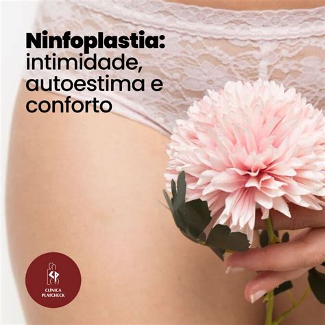 Ninfoplastia Intimidade Autoestima E Conforto Cl Nica Platcheck