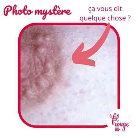 Photos mystères Le fil rouge