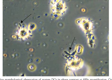[pdf] observation of dendritic cell morphology under light phase contrast or confocal laser