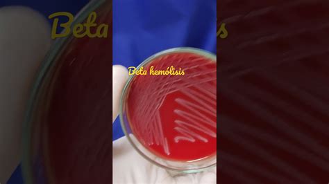Beta hemólisis en Agar Sangre YouTube