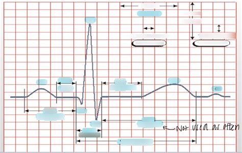 Block 4 ECG 1 Diagram ECG Waves Intervals Segments Diagram Quizlet