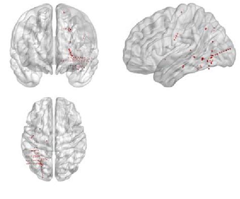 figure 2 from a p300 based brain computer interface using stereo electroencephalography signals