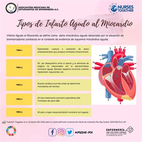 Ameenf A C On Twitter Tipos De Infarto Agudo Al Miocardio Iam