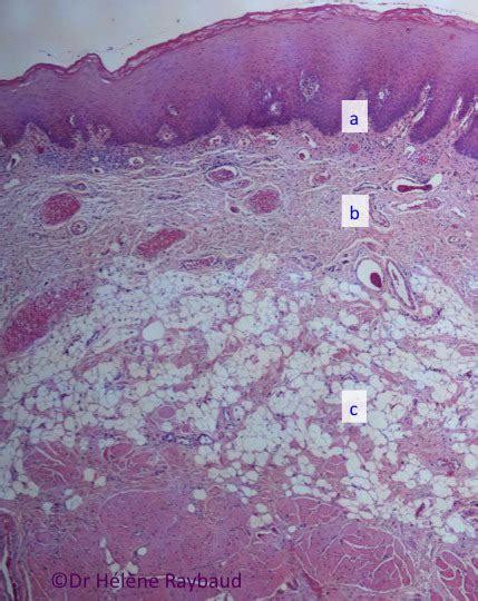 Histologie De La Muqueuse Buccale Dermatologie Buccale