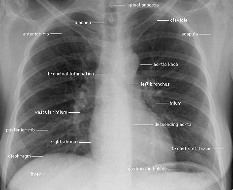 Vueltas y vueltas Tahití Carne de cordero radiologia anatomia