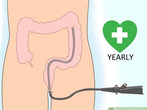 How To Avoid Small Bowel Obstruction Possibilityobligation5