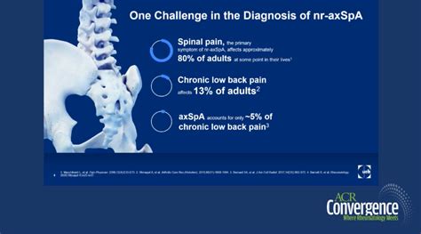 Creakyjoints Org On Twitter Although The Number Of People With