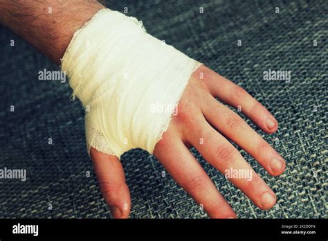 Injured Painful Hand With White Gauze Bandage Stock Photo Alamy