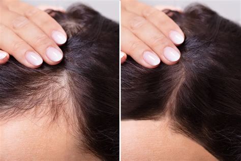 Cuál es la mejor biotina para el pelo Blog El Bazar Natural