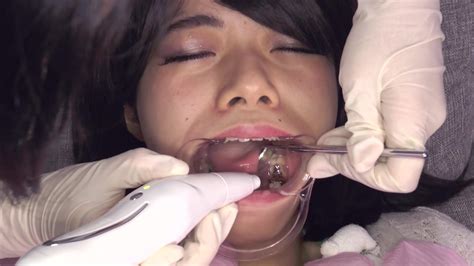 Pictures Showing For Dental Fetish Porn Mypornarchive Net