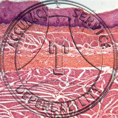 Squamous Epithelium Human Esophagus Prepared Microscope Slide