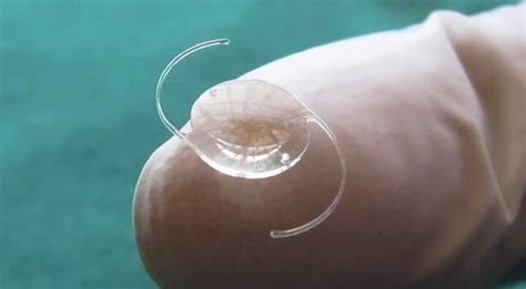 Cataracts Understand Your Lens Implant Options