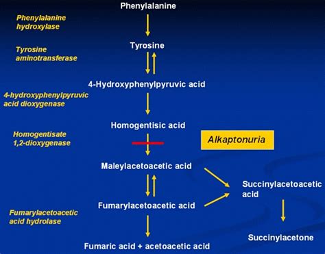 Alkaptonuria Medlibes Online Medical Library