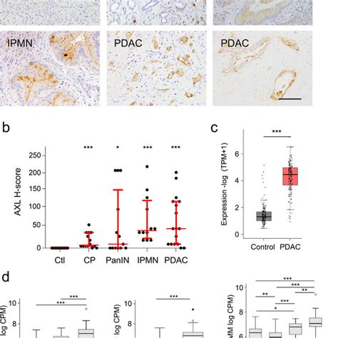 Detection Of AXL In Normal And Pathological Human Pancreatic Samples