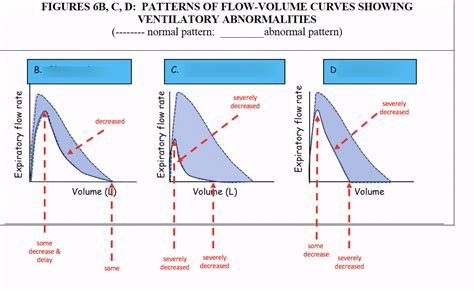 Pulmonary Function Tests And Cxr Diagram Quizlet