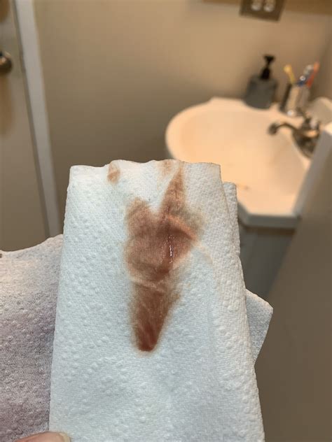 GRAPHIC PHOTO Is This Implantation Bleeding