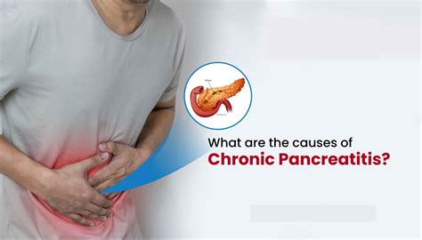 Chronic Pancreatitis Causes Symptoms Diagnosis Treatment Prognosis