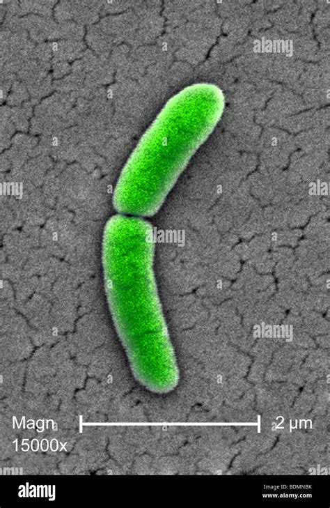 Scanning Electron Micrograph SEM Of A Single Gram Negative Salmonella