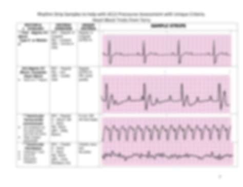 SOLUTION Cardiac Dysrhythmia Overview To Help With Acls Precourse