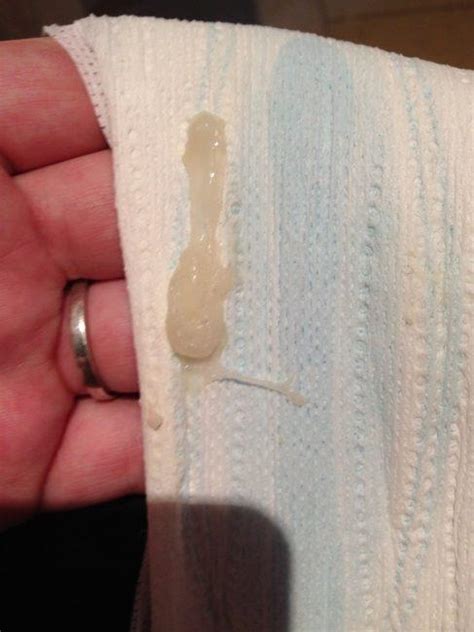 See What A Mucous Plug Looks Like Photos Babycenter